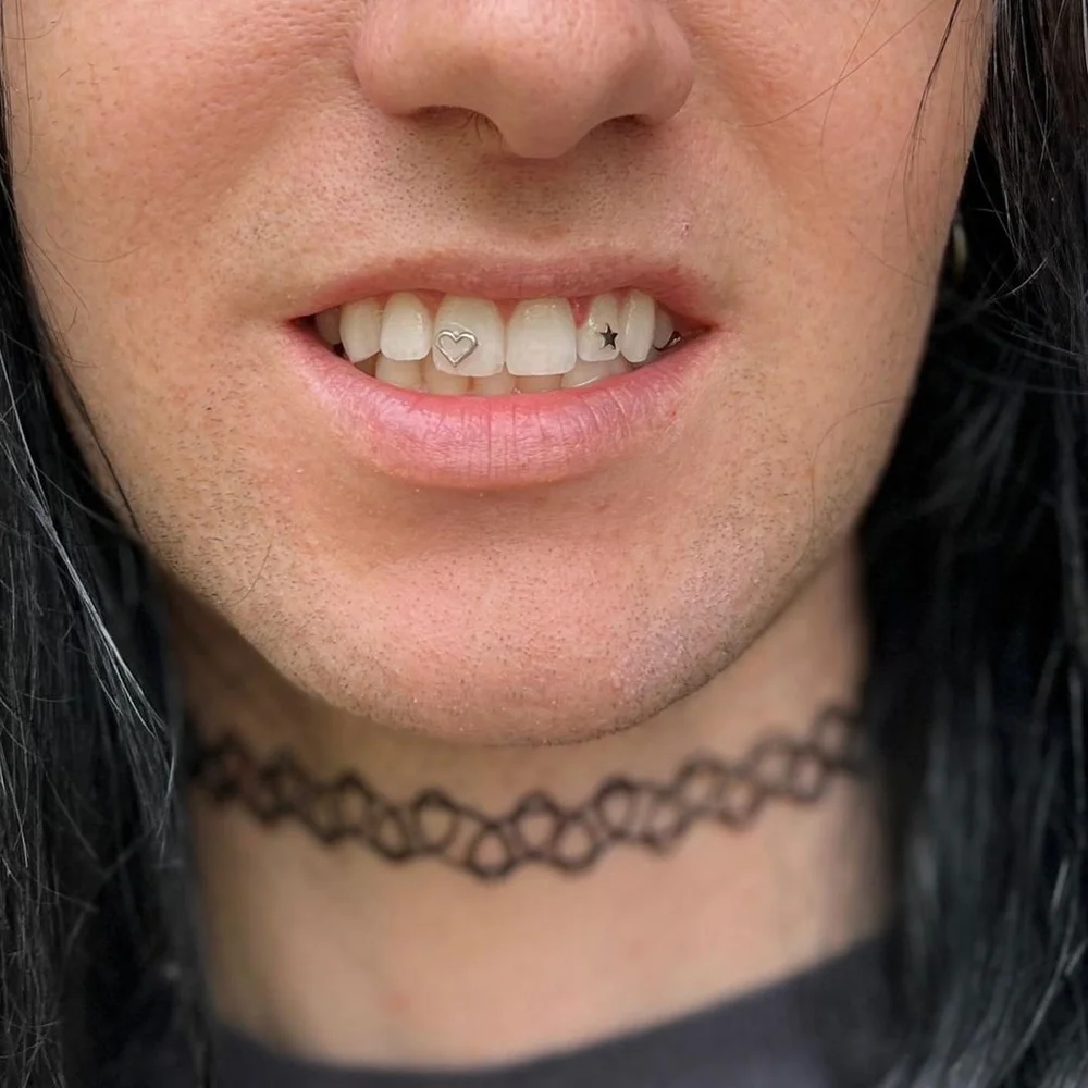 Custom Tooth Gems | Cherry Bomb Studio NYC | Enhance Your Smile Today ...
