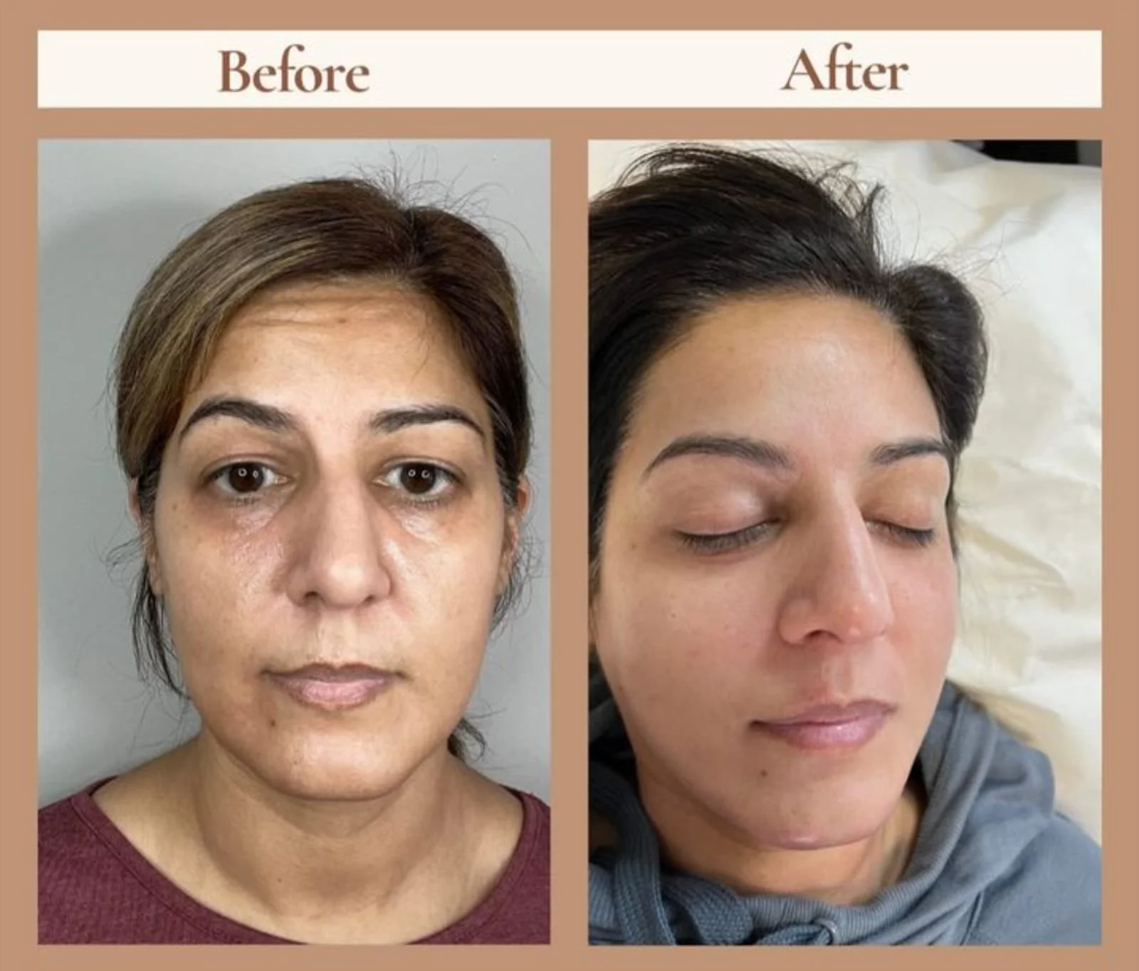 Millennium Skin and Laser: Laser Skincare & PRP in Clifton, NJ