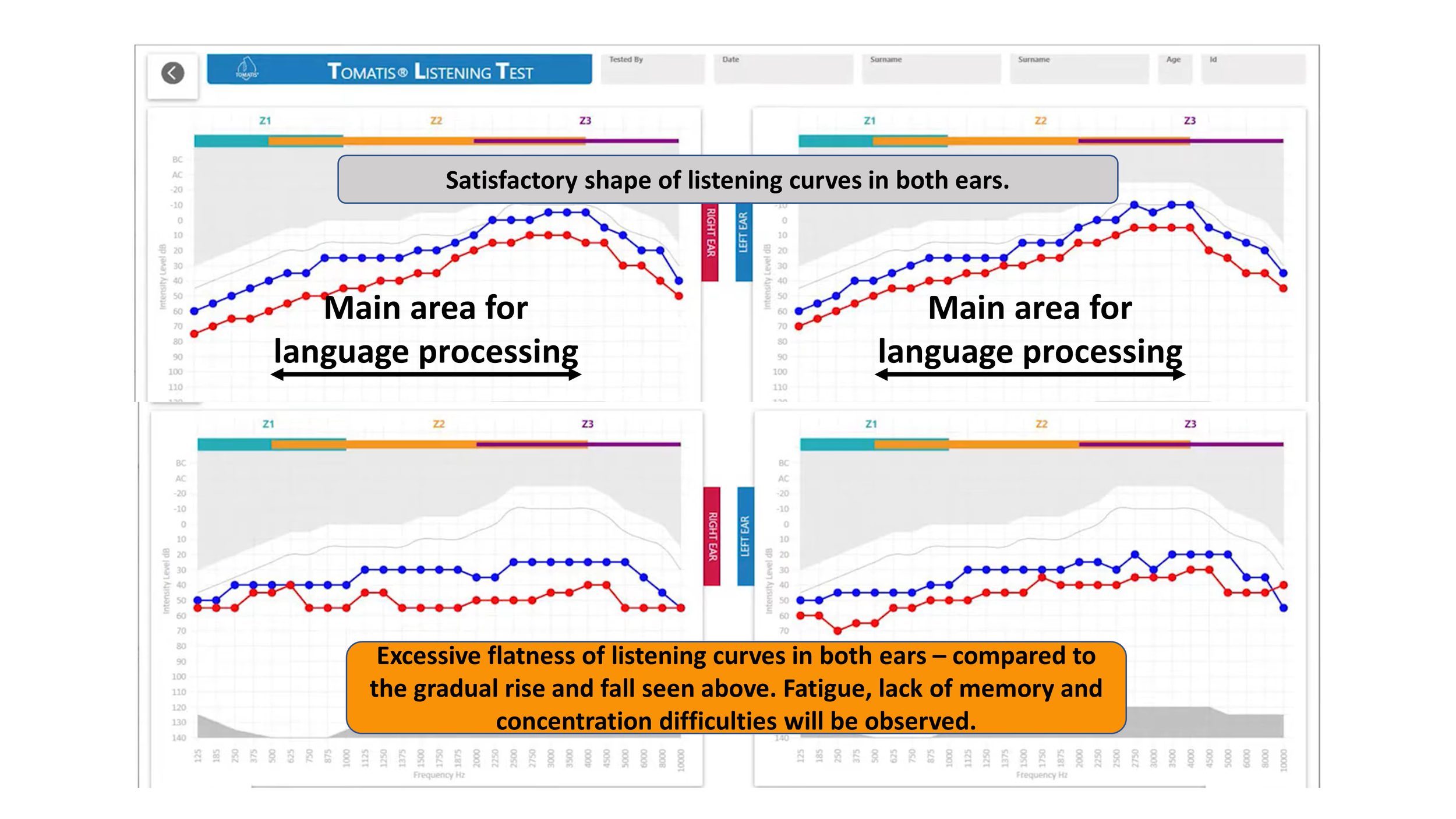 Tomatis® Listening Test (TLT®) The unique listening assessment tool ...