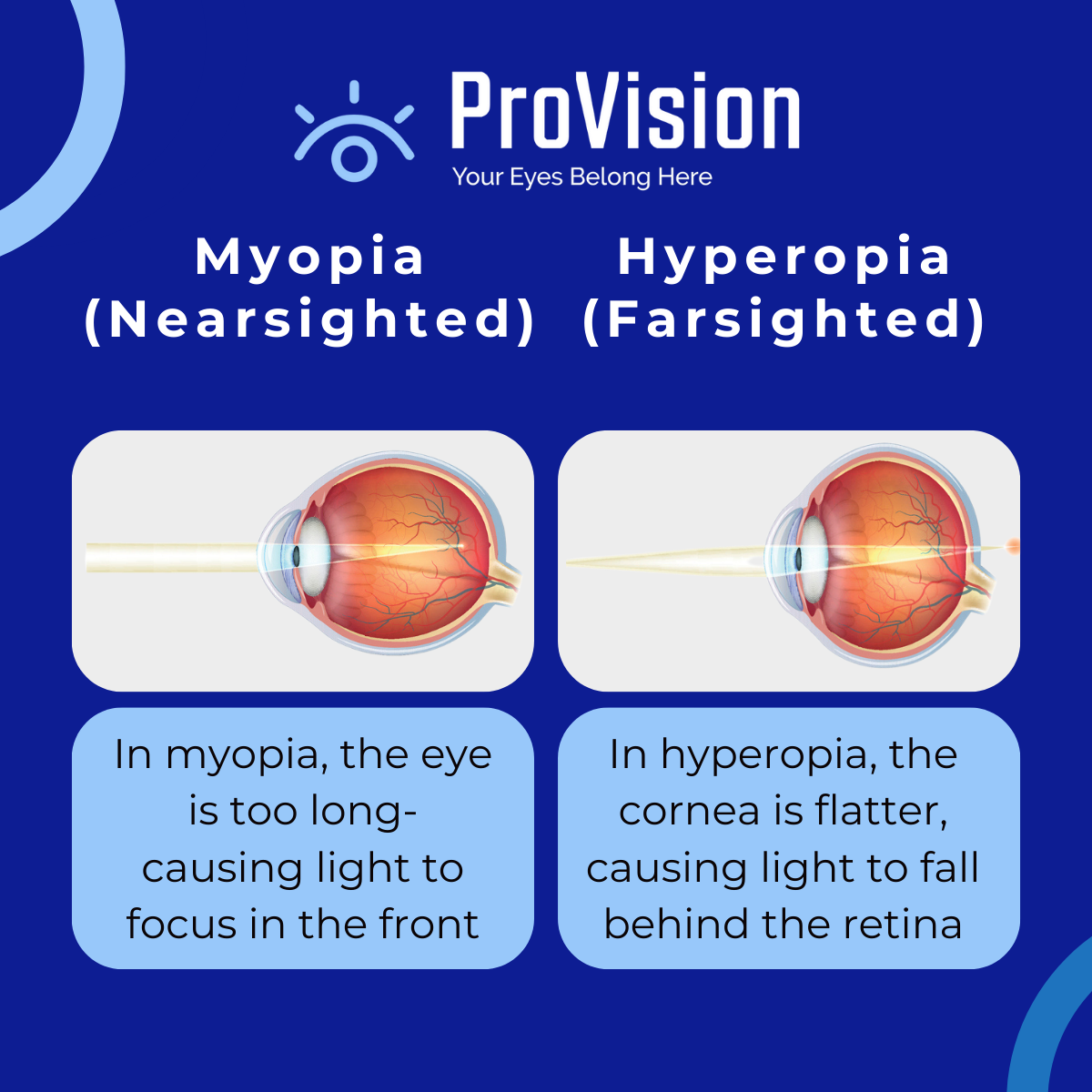 Nearsighted vs Farsighted Vision: Causes, Symptoms & Treatment ...