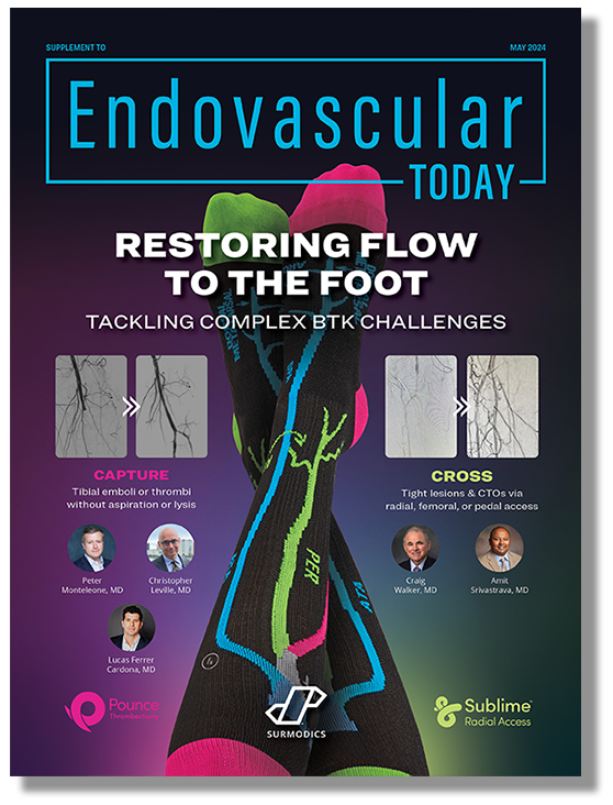 Sublime™ Radial Access Platform