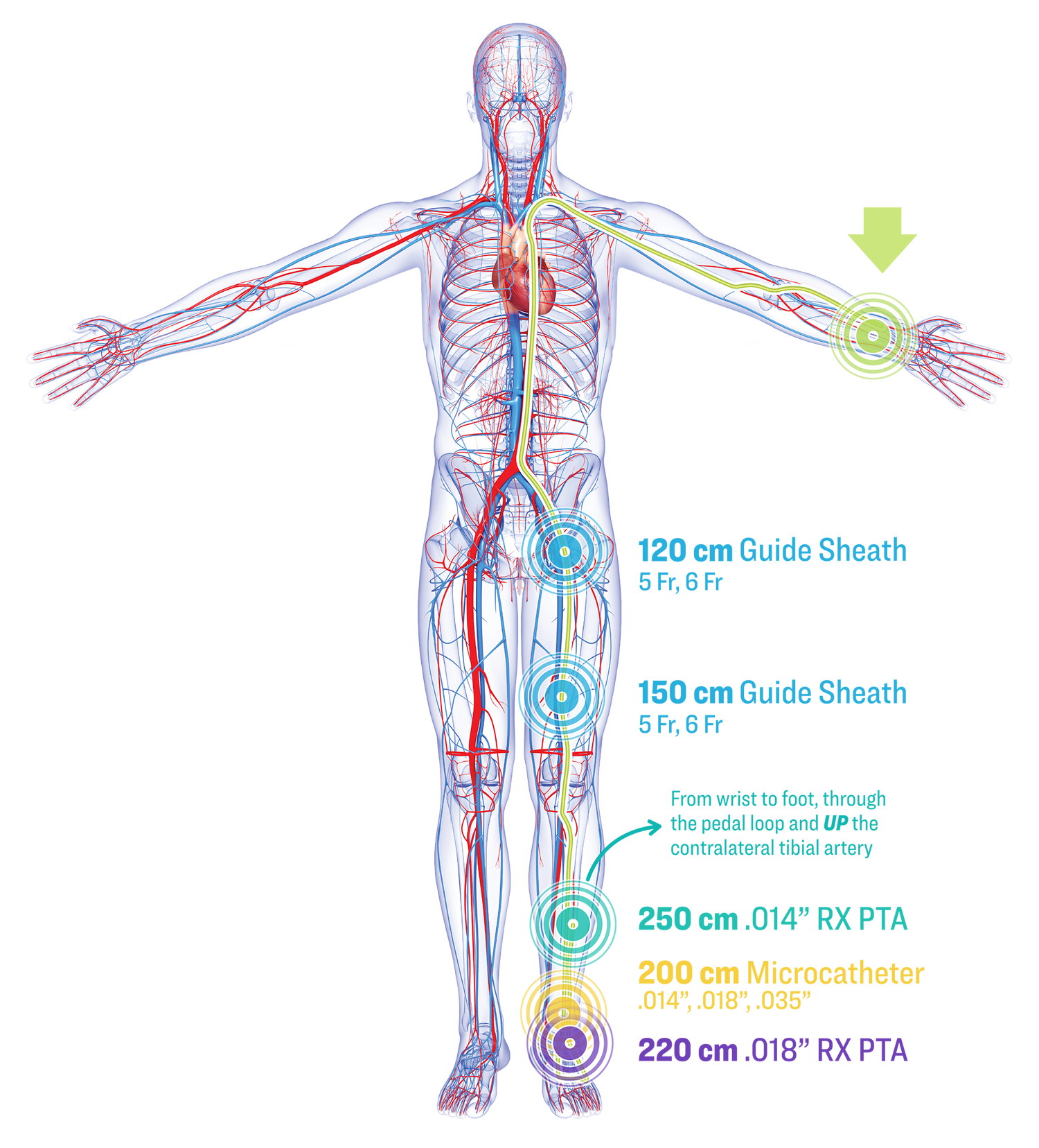 Sublime™ Radial Access Platform