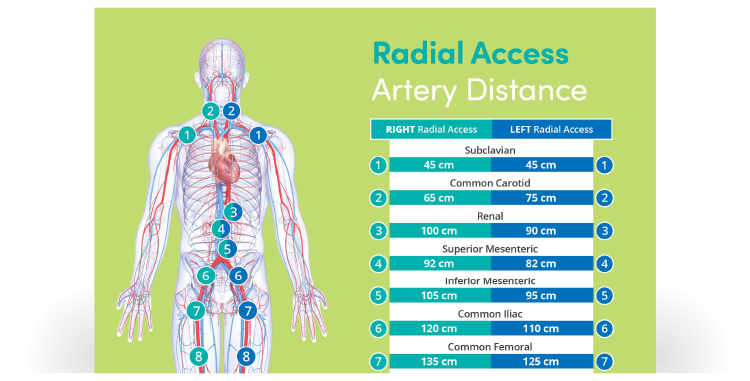 Benefits of Radial Access — Sublime™ Radial Access Platform