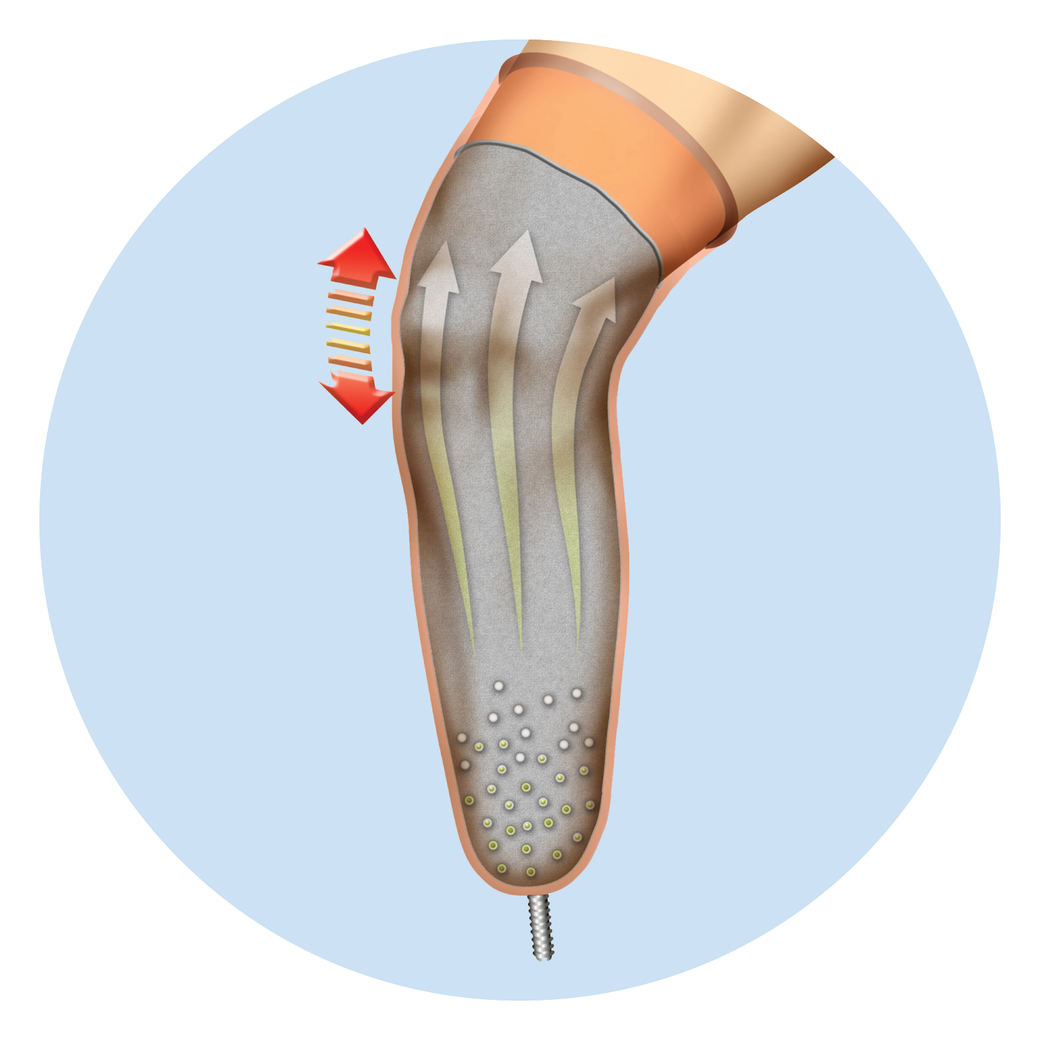 Liner-Liner — Thuasne, LLC