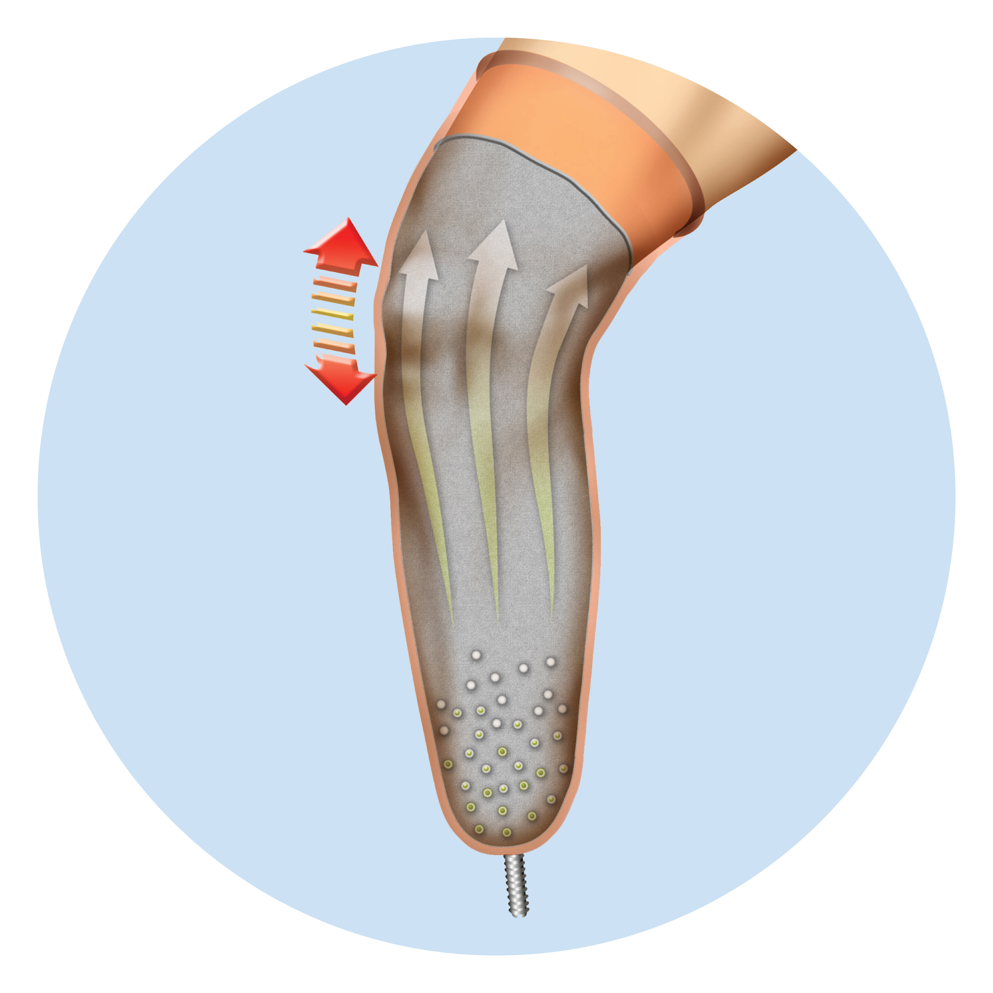 Liner-Liner — Thuasne, LLC