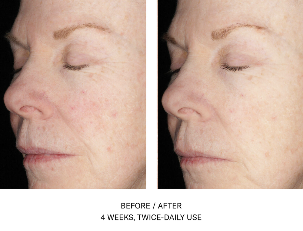 skin better in calabasas — Dr. Erin Gordon - Aesthetics