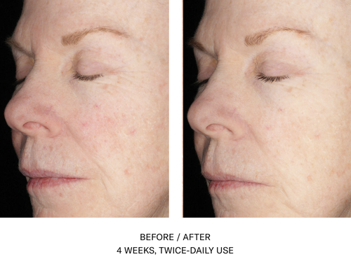 skin better in calabasas — Dr. Erin Gordon - Aesthetics