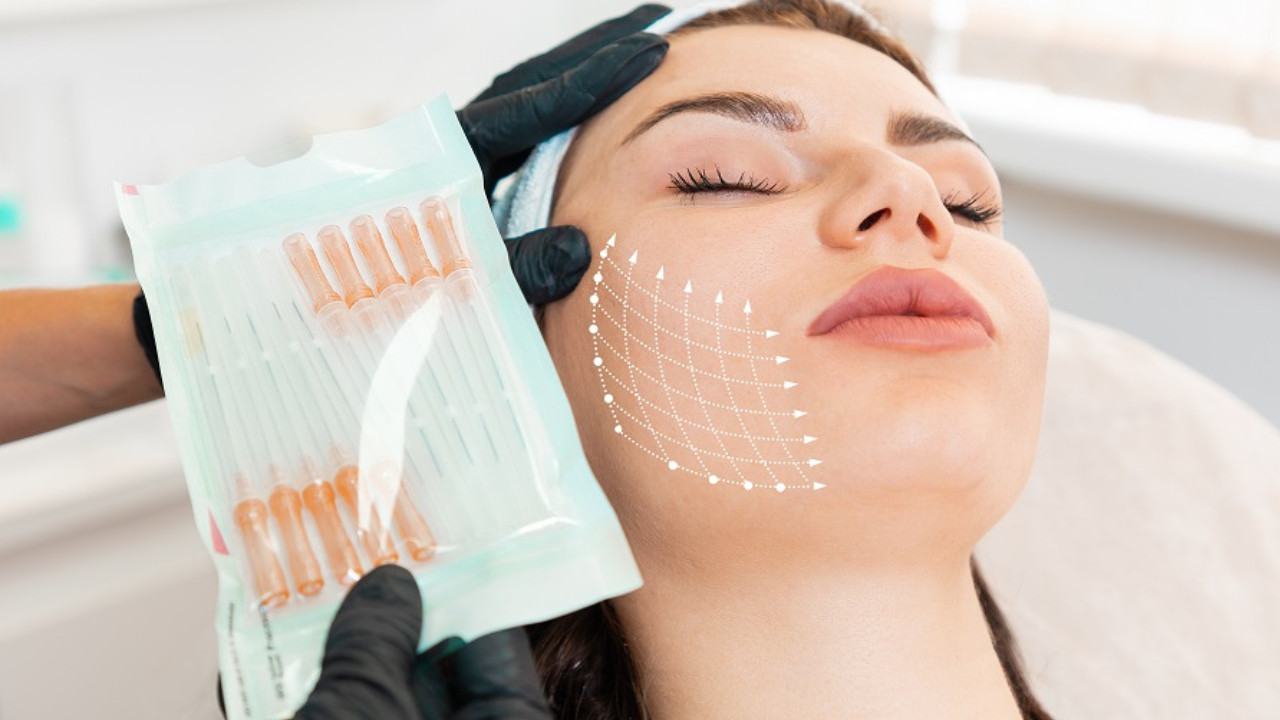 PDO Threads vs. Facelift in Calabasas — Dr. Erin Gordon - Aesthetics