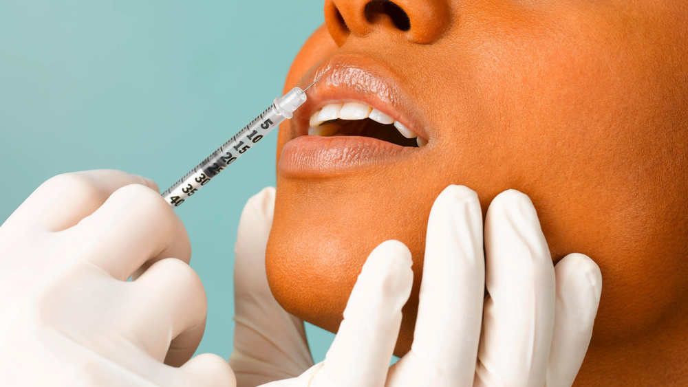 Dissolving Lip Filler in Calabasas — Dr. Erin Gordon - Aesthetics