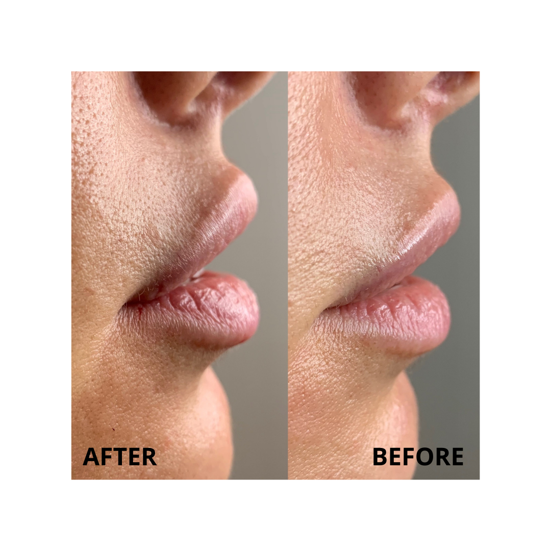 Gallery 1 — Dr. Erin Gordon - Aesthetics