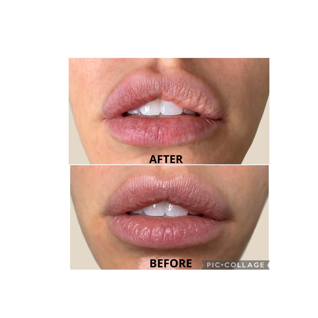 Gallery 1 — Dr. Erin Gordon - Aesthetics