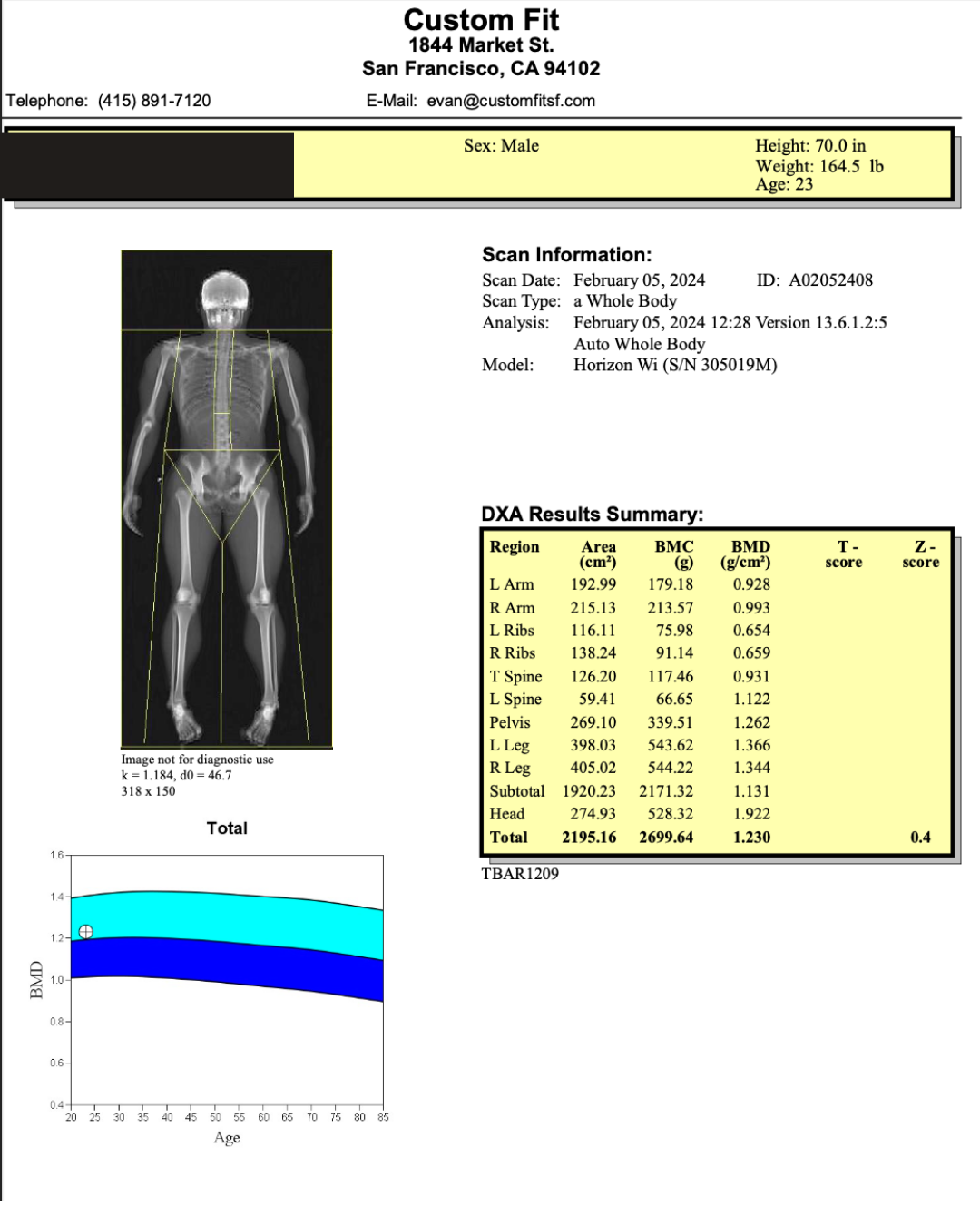 Sample Report — DEXA SF