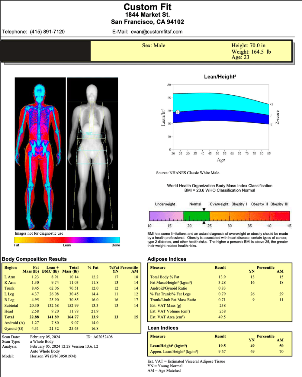 Sample Report — DEXA SF