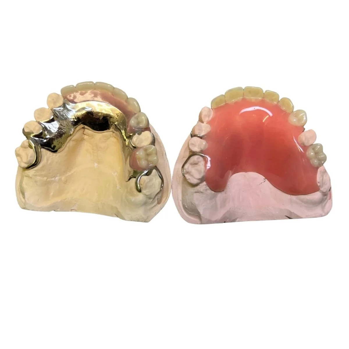Benefits Of Chrome Partial Dentures | All Smiles