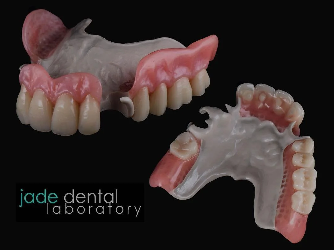 Partial Flexible Dentures | All Smiles Denture Clinic