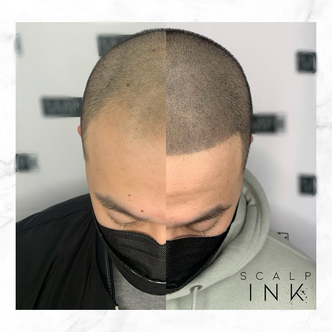 Scalp Ink LV
