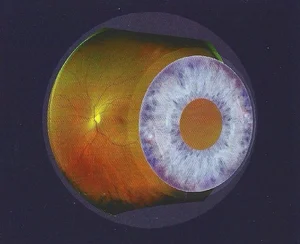Optomap Imaging — Expert Eye & Ear Care, Arthur Hayes Opticians