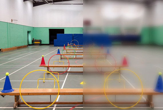 Myopia Explained — Expert Eye Care, Arthur Hayes Opticians