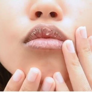 Dry vs Dehydrated Skin: How To Tell The Difference — Fiona Brackenbury
