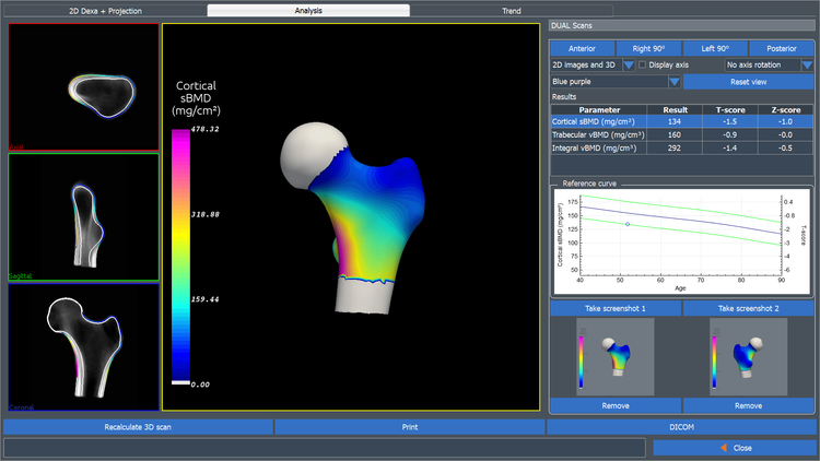 Bone Monitoring Clinic AB - DXA-skanning — BMC osteoporosmottagning ...