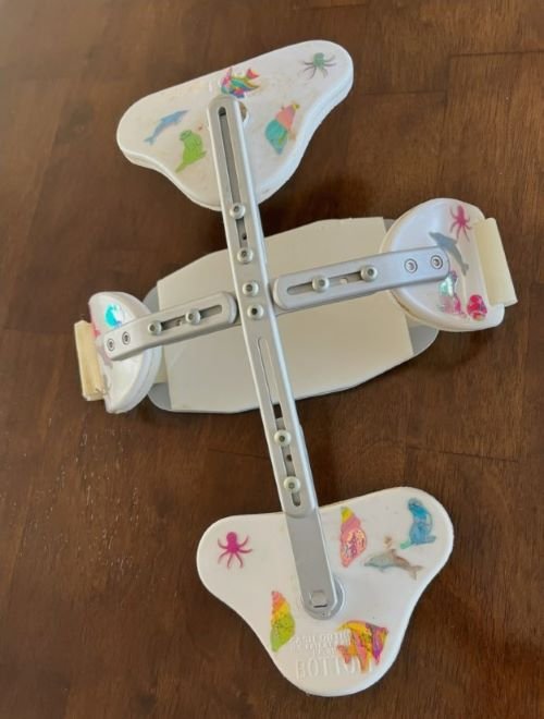 Chronic pain and gratitude: the story of my broken back — Blue Mala ...