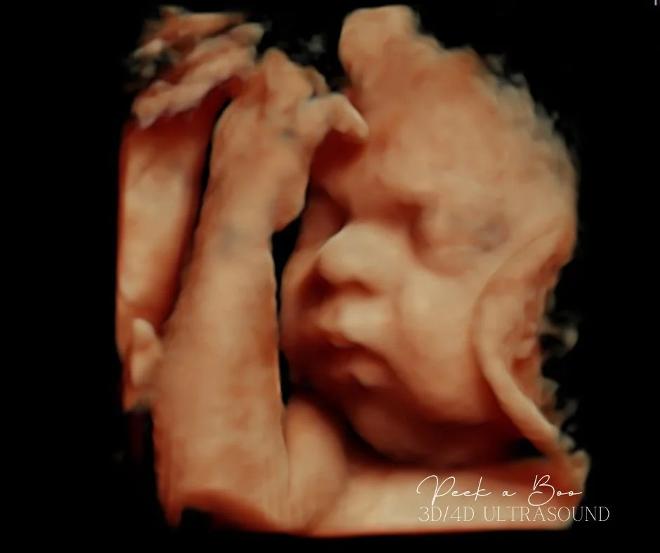 Peek a Boo 3D/4D Ultrasound