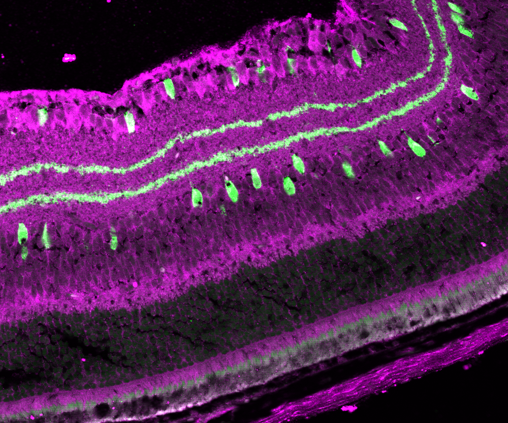 Techniques — Tiriac Lab