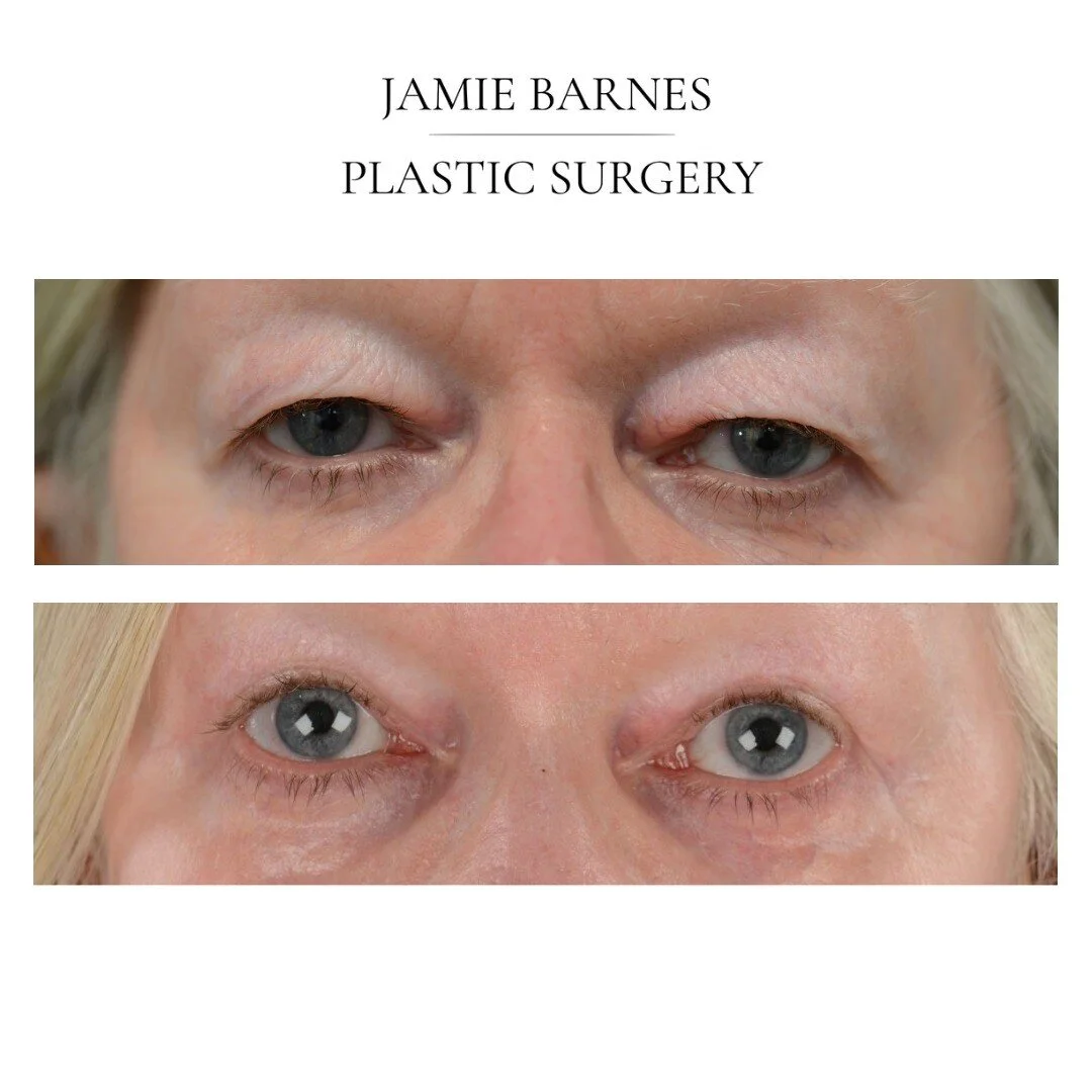 Jamie Barnes Plastic Surgeon - Plastic Surgery in Liverpool, Chester ...