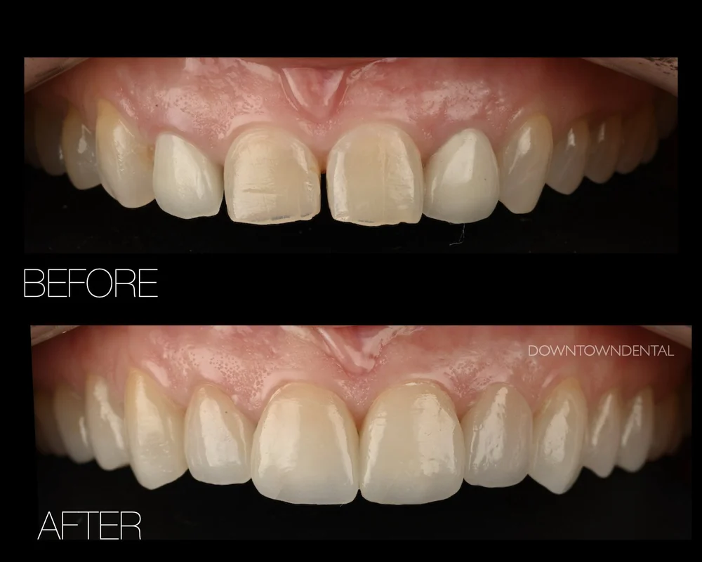 Downtown Dental Clinic | Advanced Dental Treatment Center Westfield NJ