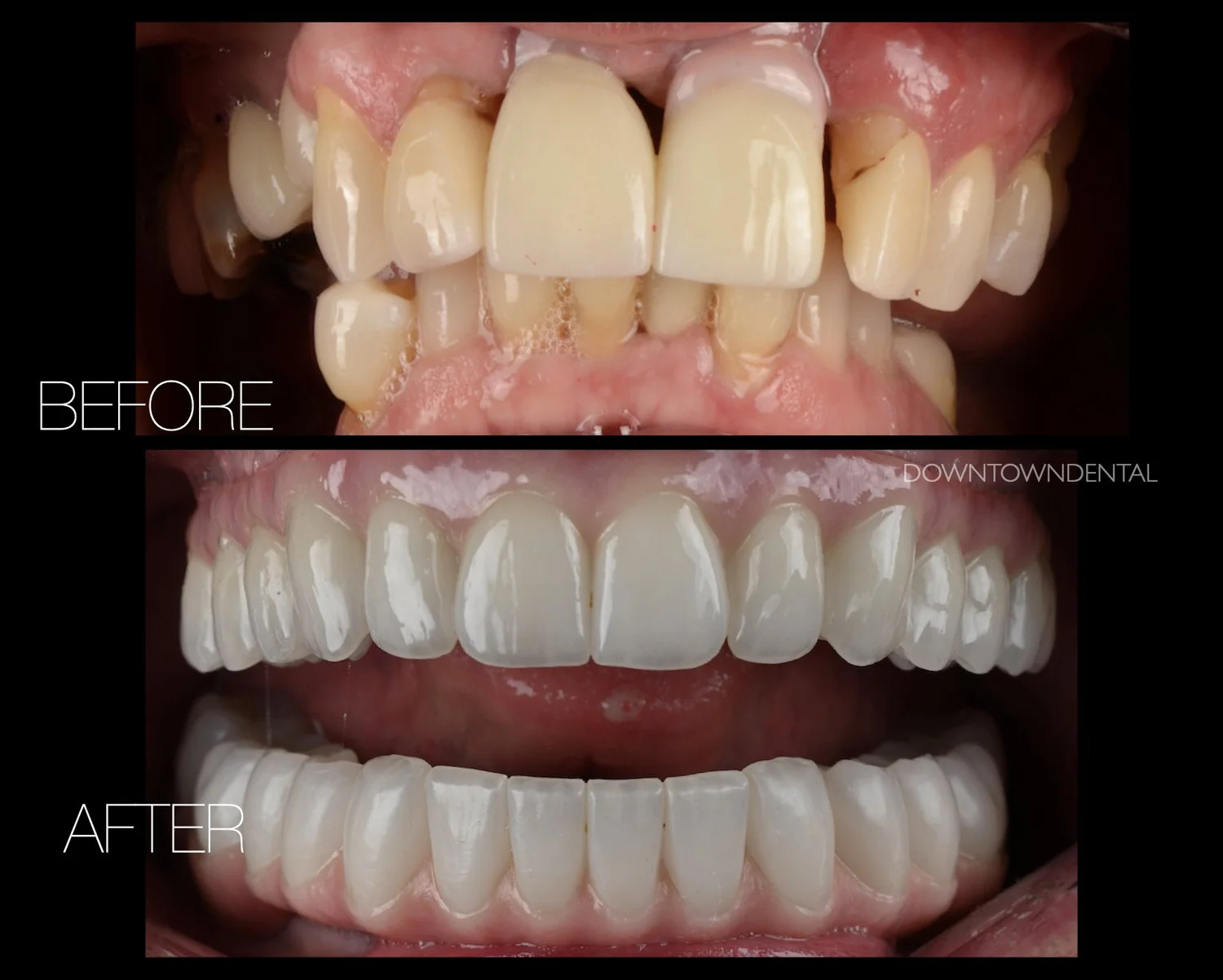 Downtown Dental Clinic | Advanced Dental Treatment Center Westfield NJ