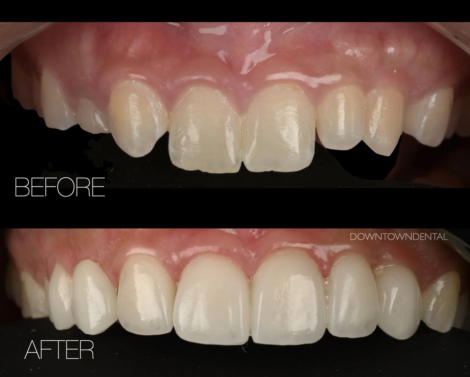 Downtown Dental Clinic | Advanced Dental Treatment Center Westfield NJ