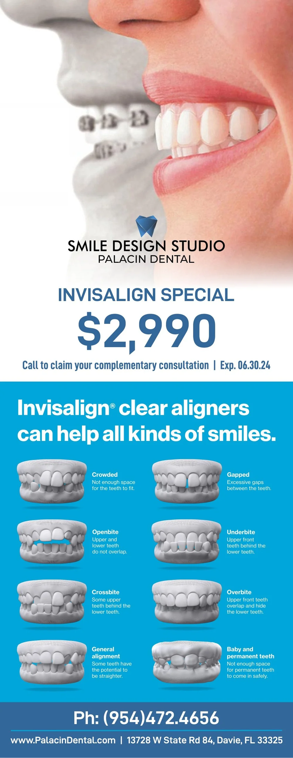 Invisalign Promo — PALACIN DENTAL ~ SMILE DESIGN STUDIO