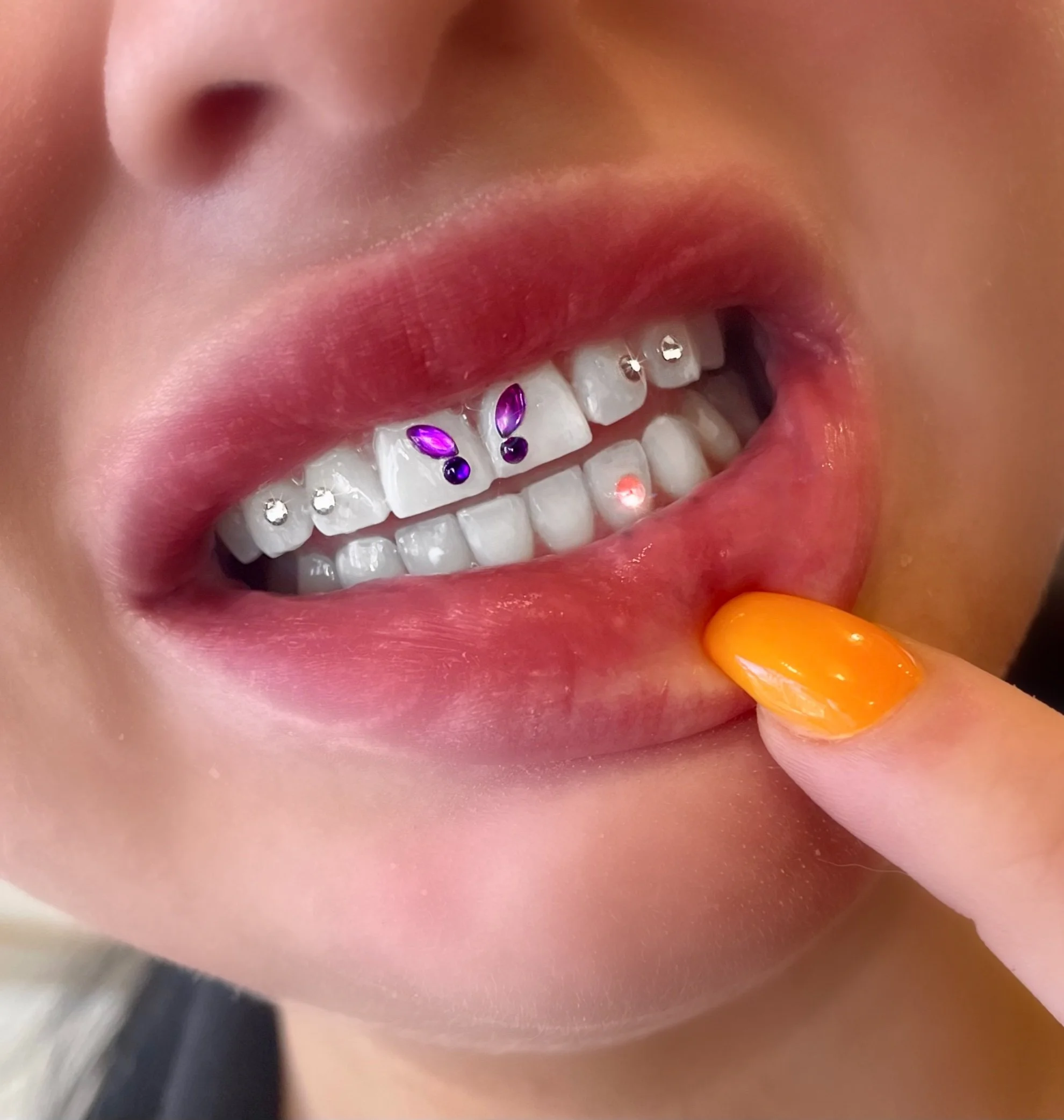 Best Tooth Gems in Edmonton | Studio Vanassa Tooth Gems — STUDIO VANASSA