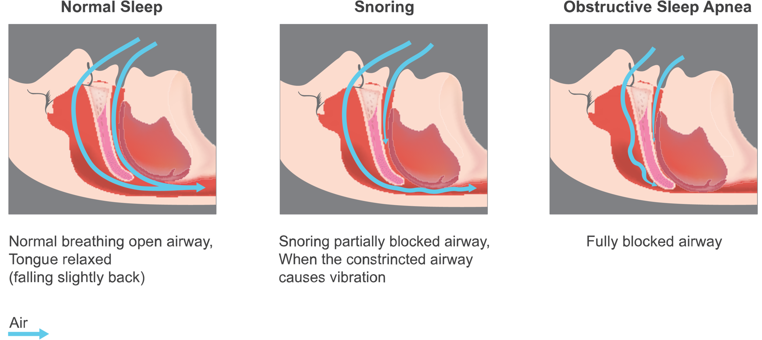 Dangers Oxygen Desaturation — Sleeptopia, Inc | CPAP Supplies