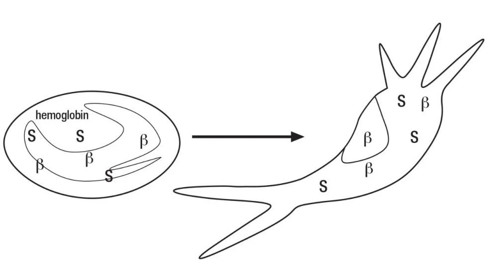 Sickle Cell Disease & Trait — Sickle Cell Foundation of Minnesota
