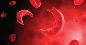 Sickle Cell Disease & Trait — Sickle Cell Foundation of Minnesota