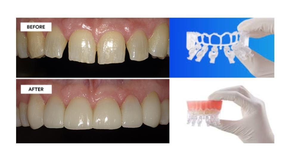 Clinical Events — NECADE