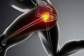 The 6 stages of Proximal Hamstrings Tendinopathy Recovery — Benji Physio