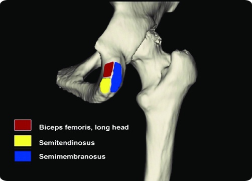 The 6 stages of Proximal Hamstrings Tendinopathy Recovery — Benji Physio
