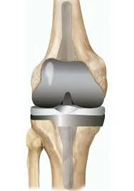 Knee Replacement Class — Benji Physio