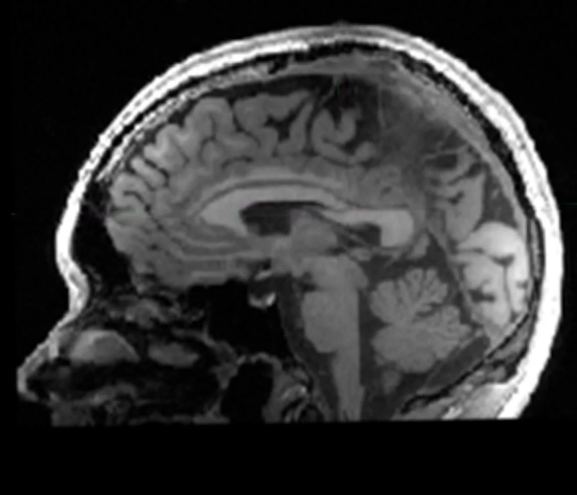 Center for Neurolaw and Equity