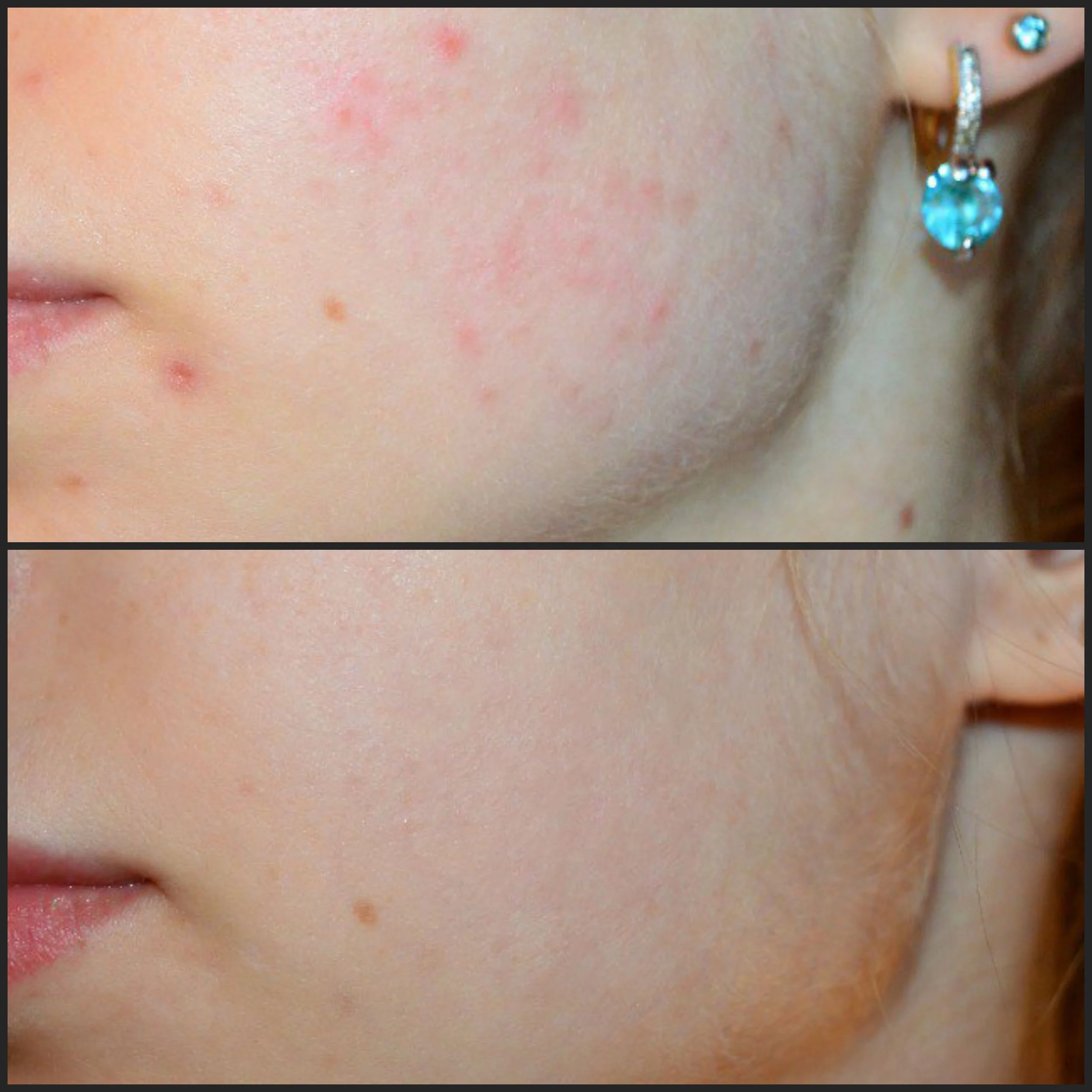 Probiotic Facial Essence - No. 4 RECOVER - HydroFlora Balancing Mist ...