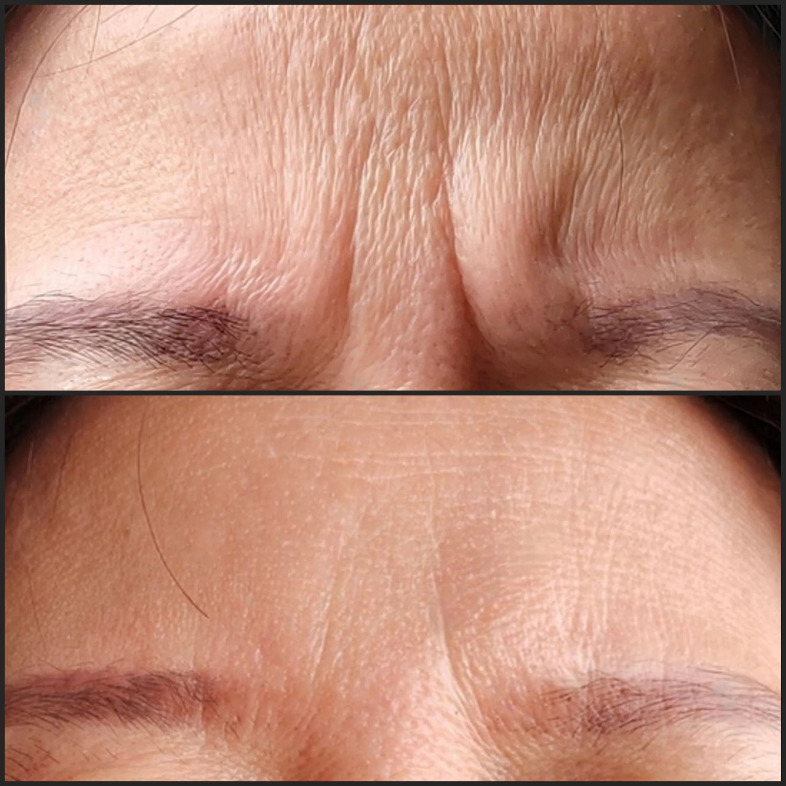 Probiotic Facial Essence - No. 4 RECOVER - HydroFlora Balancing Mist ...
