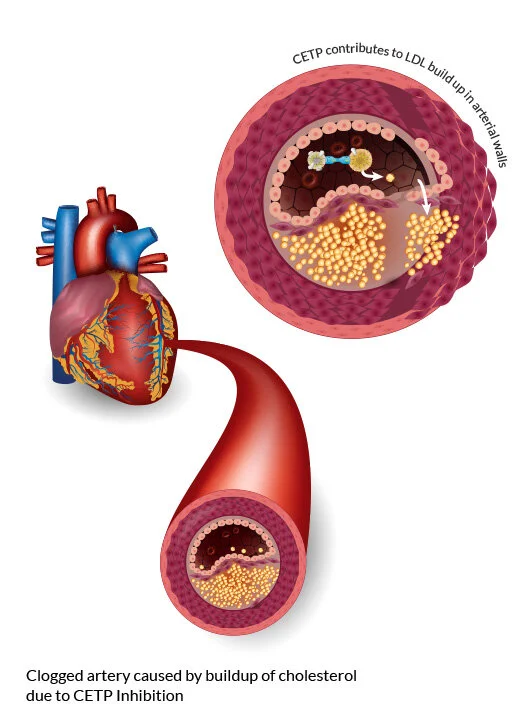 About — New Amsterdam Pharma