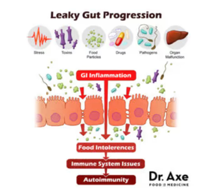 Understanding & Identifying Leaky Gut — The KAN Clinic