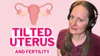 Demystifying the Tilted Uterus: What It Means for Your Fertility and ...