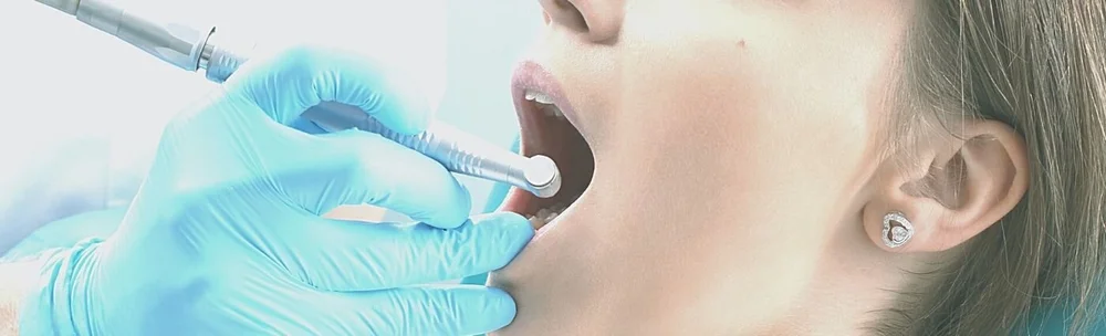 Simply: Root Canals — The Richmond Dental Centre