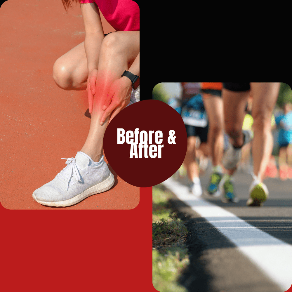 Shin Splints in Runners: Causes, Treatment & 5‑Day Recovery Plan ...