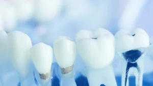 Queensland Endodontics