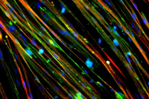 Module 8: Ethical Issues in Stem Cell Research — International Society ...